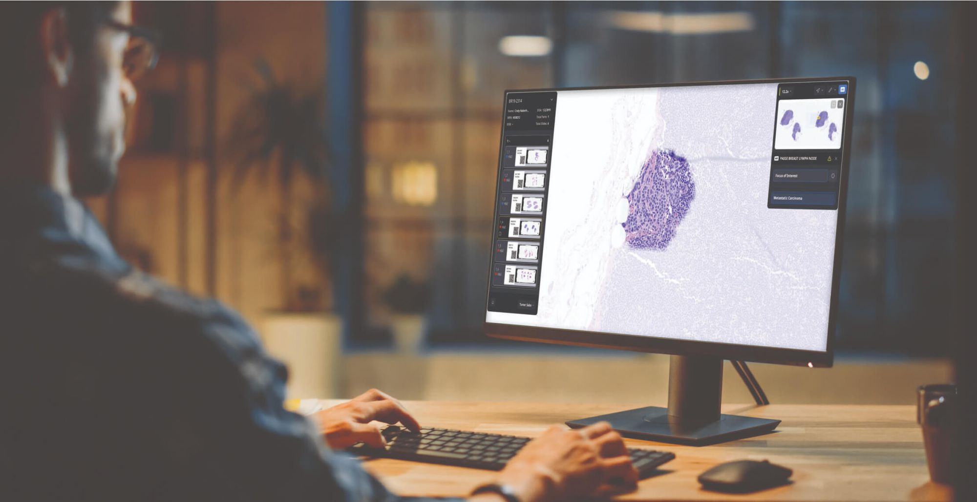 Paige and Microsoft are Building the World's Largest AI Model to Detect ... Paige and Microsoft are Building the World's Largest AI Model to Detect ...